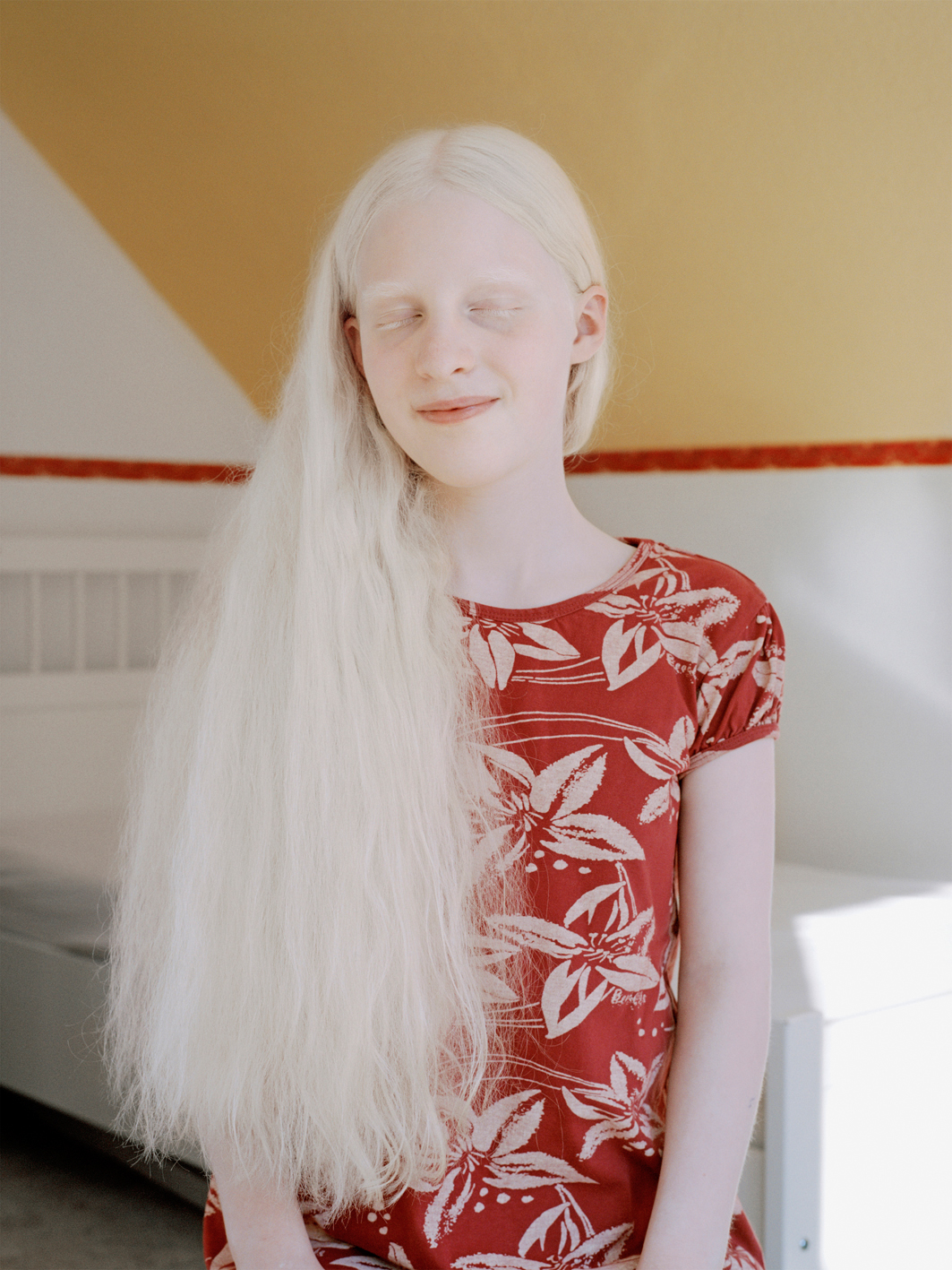 IM EIGENEN LICHT/PORTRAITS VON MENSCHEN MIT ALBINISMUS – HEIDE PRANGE